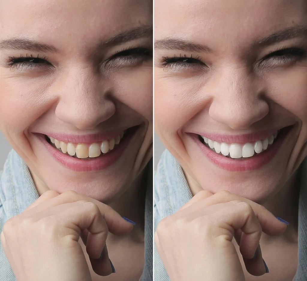 Professional Model Photo Retouching Service | PixelPhant