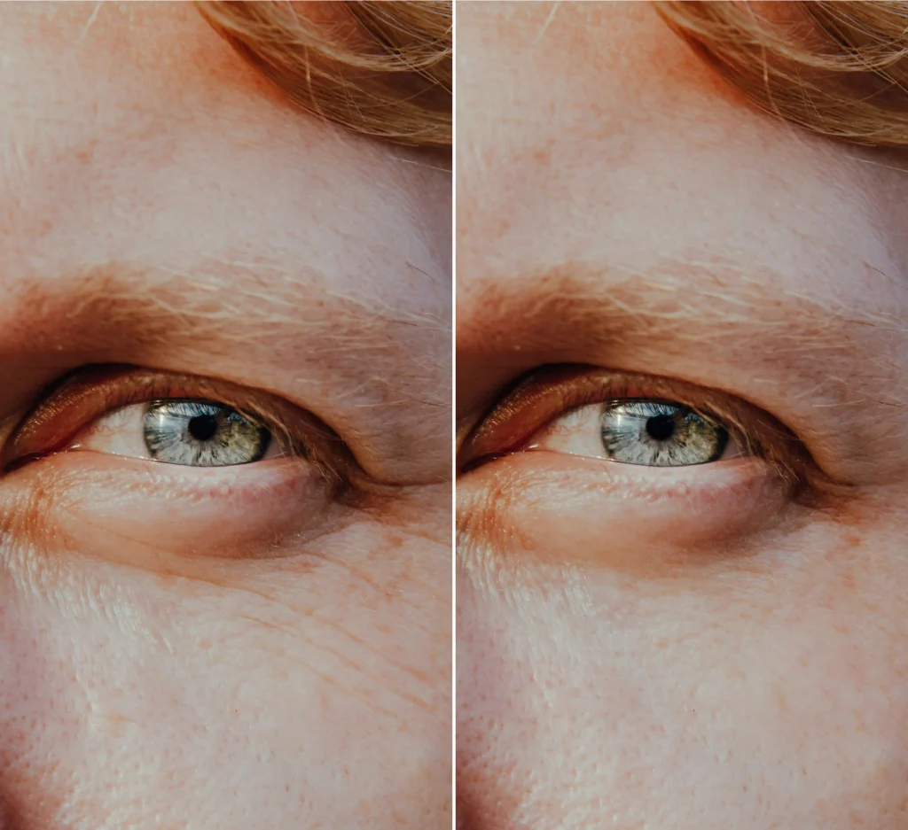 Professional Model Photo Retouching Service | PixelPhant